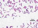 Bacillus sphaericus